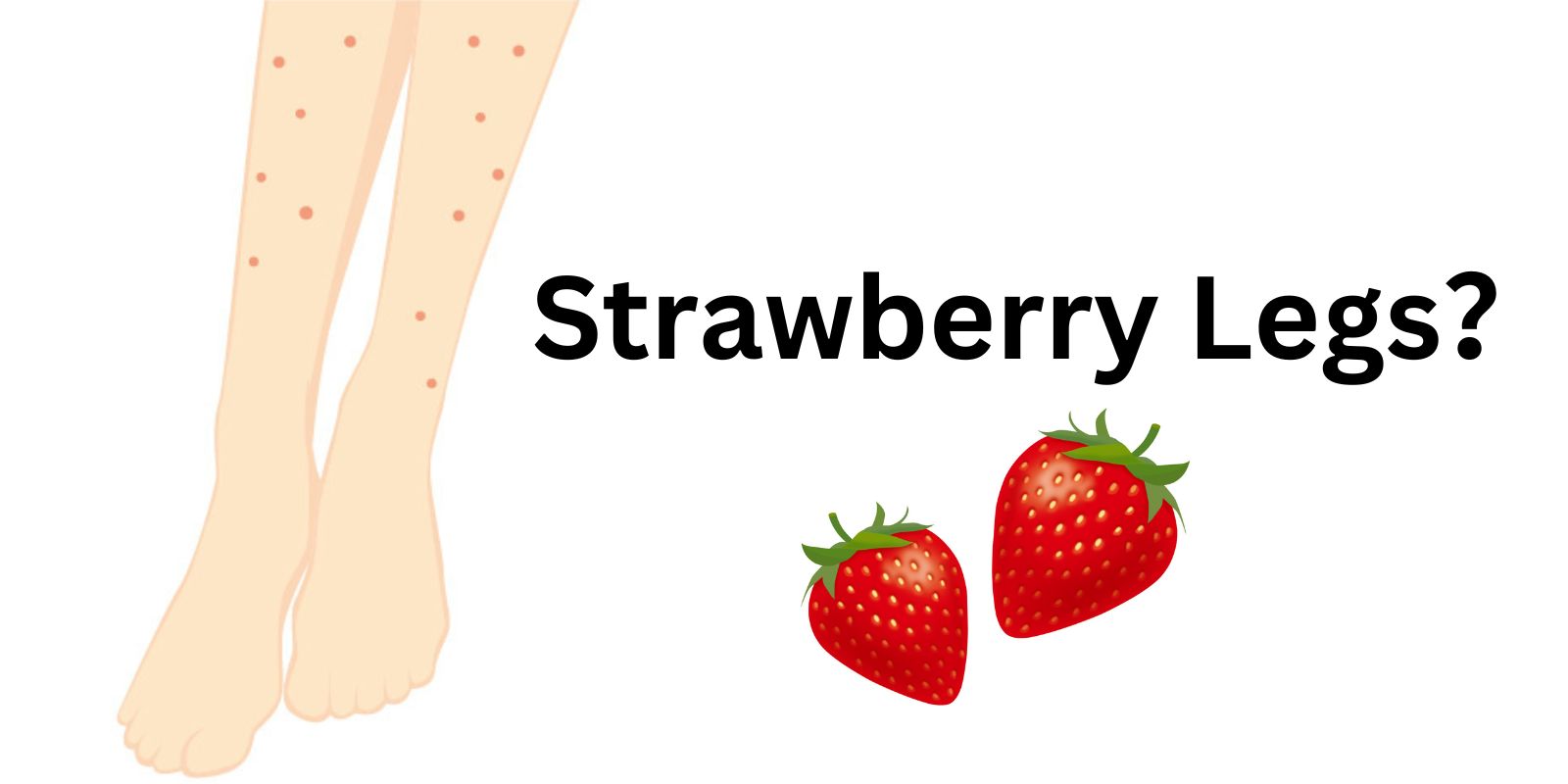 Strawberry Legs Setsuko Beauty Clinic